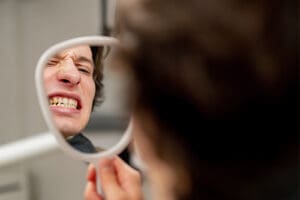 Gingival flap surgery | gum disease treatment | Periodontist